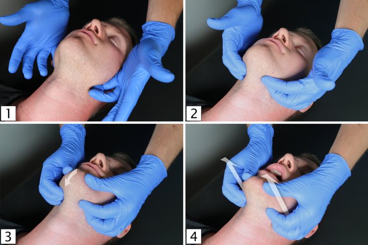Techniques For Opening An Airway On An Unconscious Patient ...