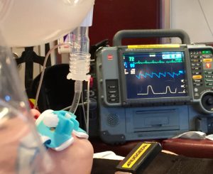 Automatic Transport Ventilator/Resuscitator – georgiaemsacademy.com