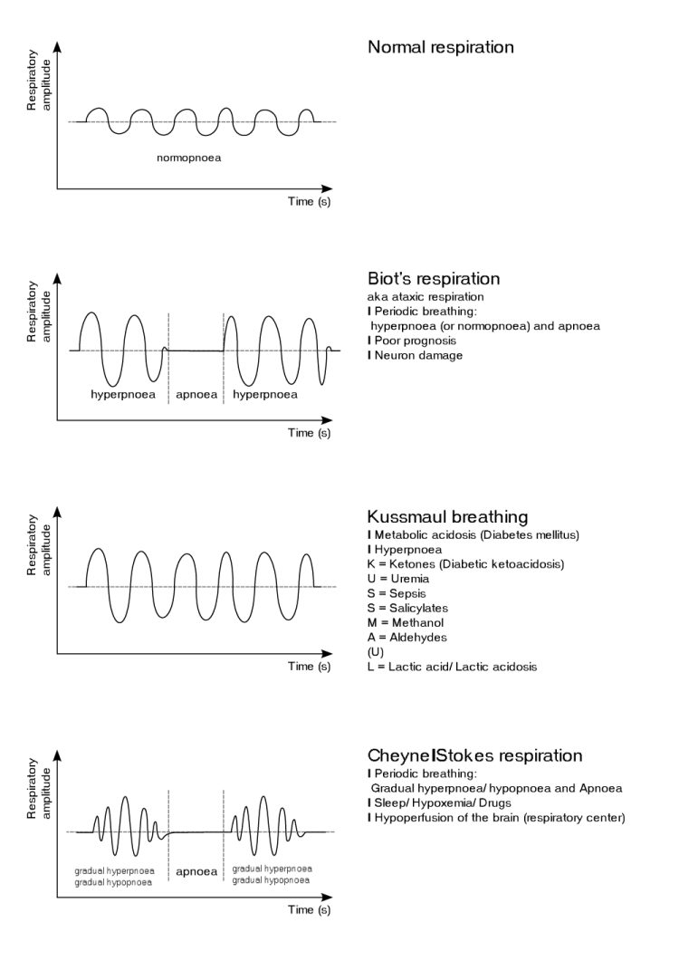 Abnormal Breathing From Head Injuries – georgiaemsacademy.com